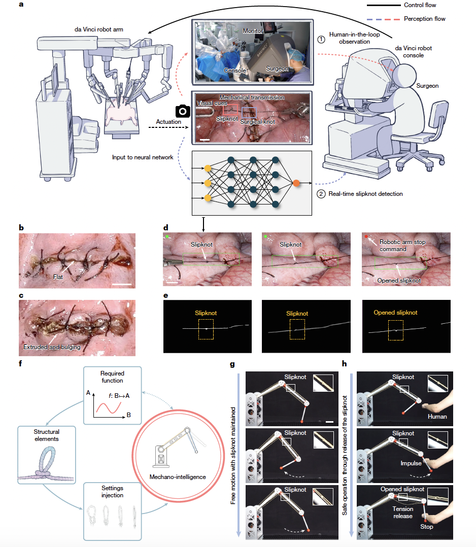 Suture to Safety: How an Intelligent Knot Is Standardizing Surgical ...